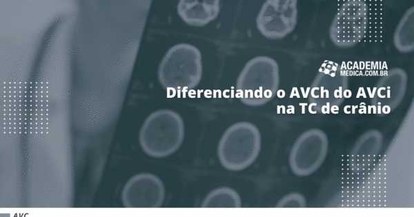 Diferenciando o AVCi do AVCh na TC de crânio - Academia Médica