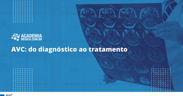 AVC: do diagnóstico ao tratamento - Academia Médica
