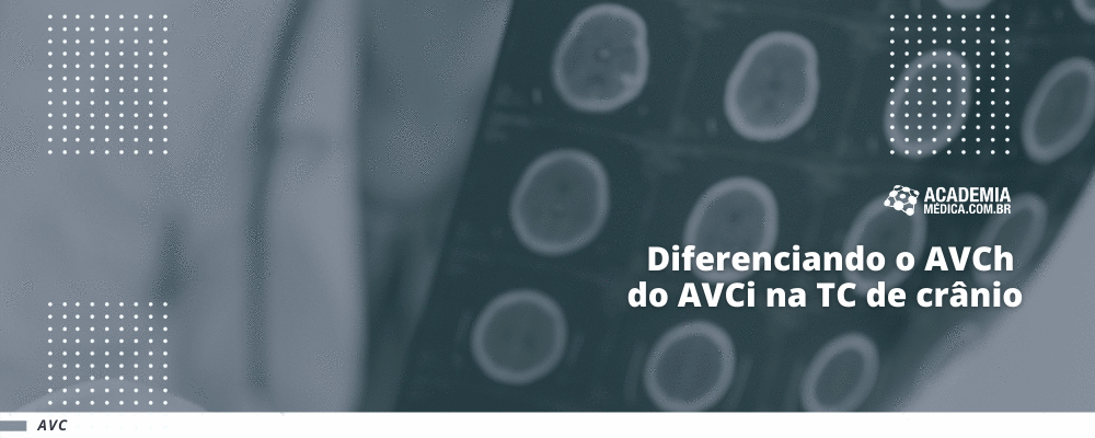 Diferenciando o AVCi do AVCh na TC de crânio - Academia Médica